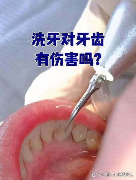 超声波洗牙疼吗图标