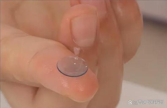 ok镜几年换一次