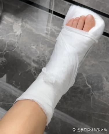 脚趾骨折怎么固定图标