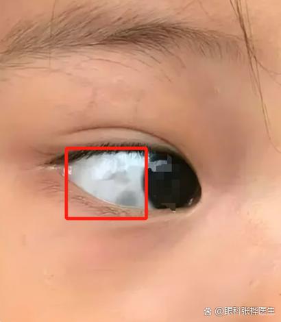 只有眼白的眼睛图片图标