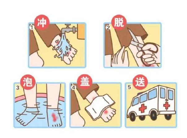 被烫伤了涂什么比较好截图