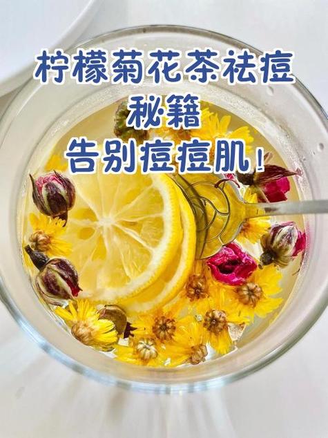 喝柠檬水可以祛痘祛痘印吗图标