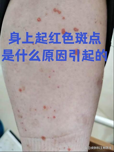 苹果屏幕上的红斑是什么图标