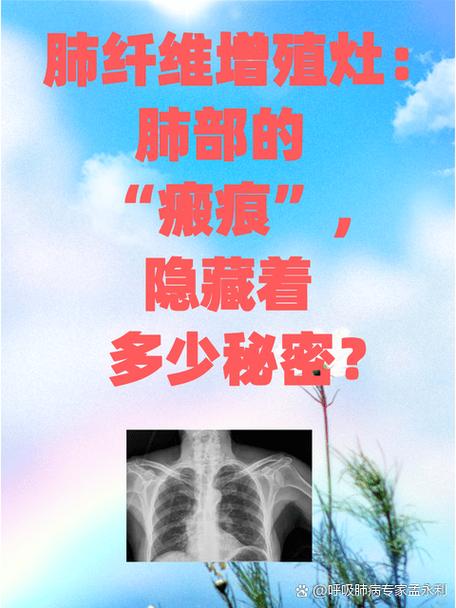 rt3医学上代表什么图标
