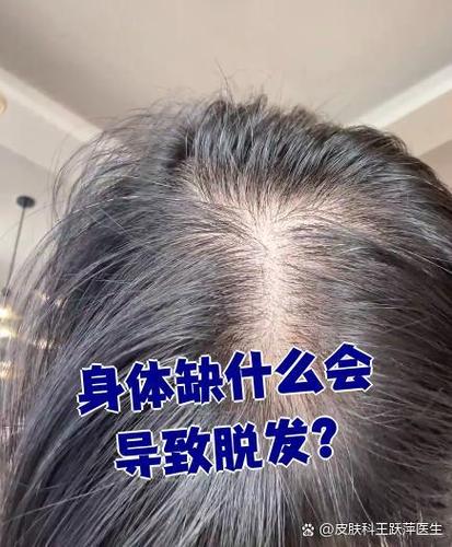 身体缺什么容易掉头发图标