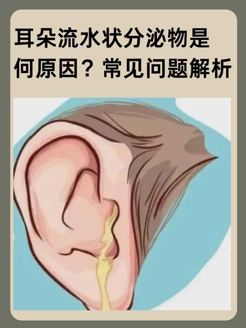 耳朵里有不明液体是怎么回事图标