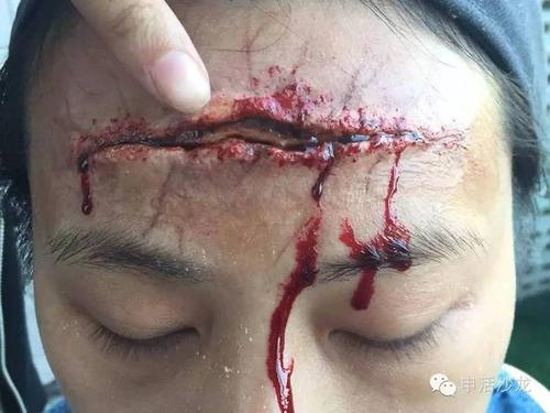 脸部受伤特效妆图片图标
