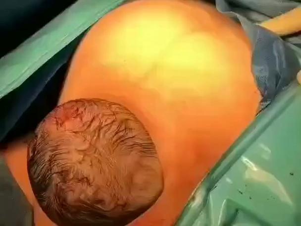 男人生宝宝难产了图标
