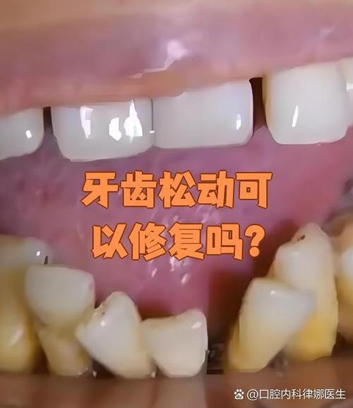一颗牙齿松动怎么办截图