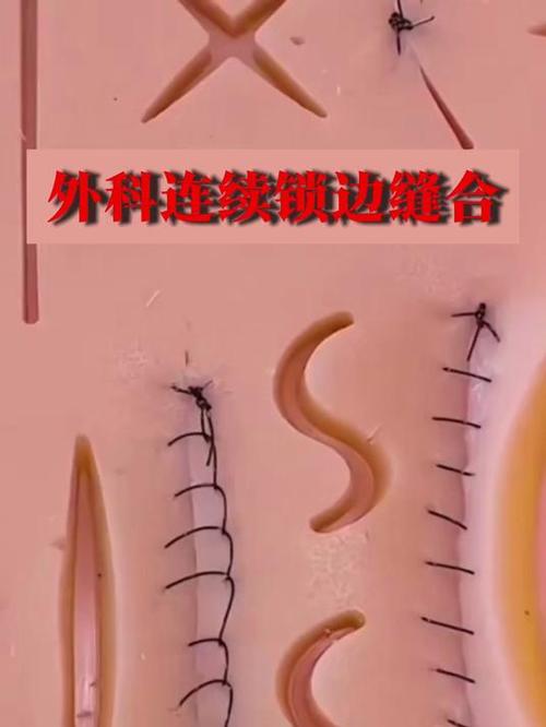 缝针拆线的正确方法图标