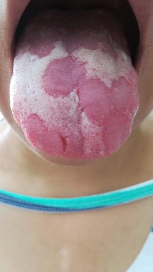 舌头上有白色空心圆圈图标