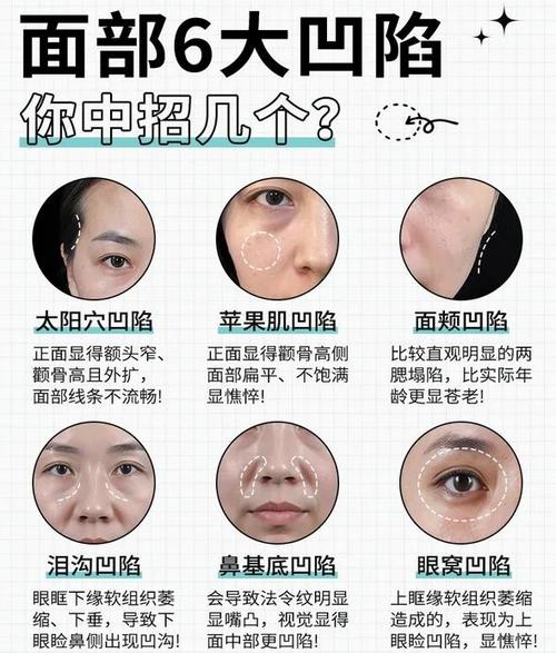 30岁脸部凹陷怎么办图标