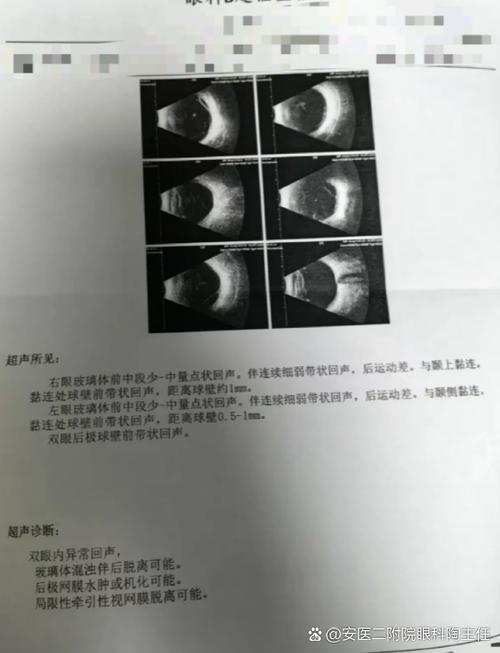 拍照灯光闪烁是什么原因图标