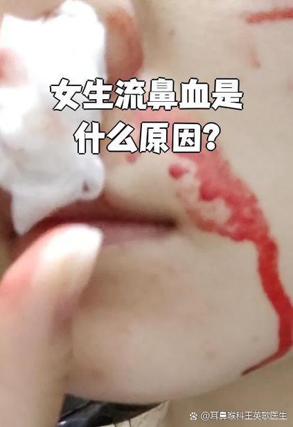 少女流鼻血图标