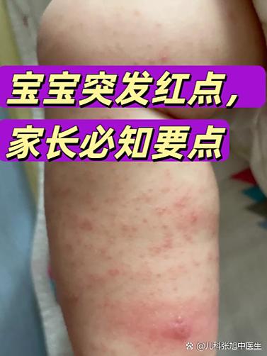 过敏是什么原因引起的