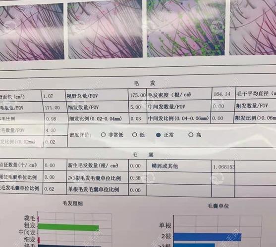 猫咪毛里面硬硬的东西图标
