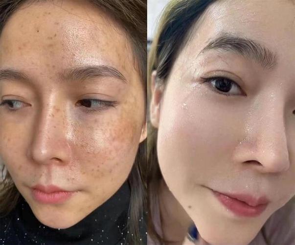 美白淡斑第一名国货图标