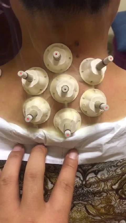 梅花灸视频教程截图