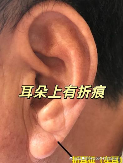 单耳耳机伤耳朵图标