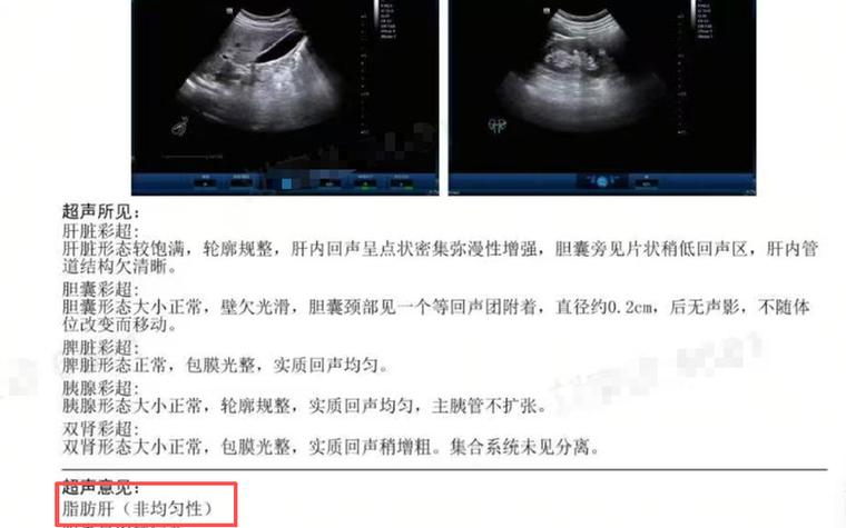 b超能查出什么截图