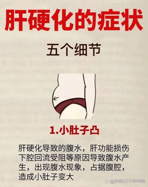 肝病的症状图标