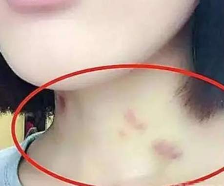咬脖子会咬死人么图标