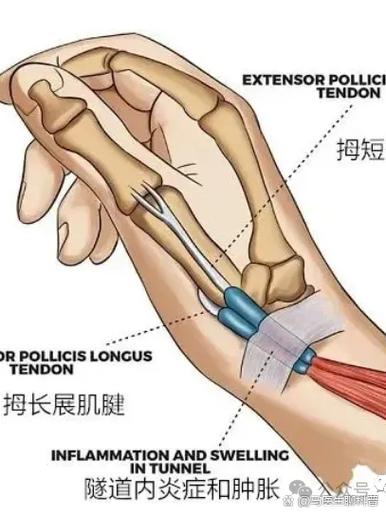 手卡顿一招恢复缩略图