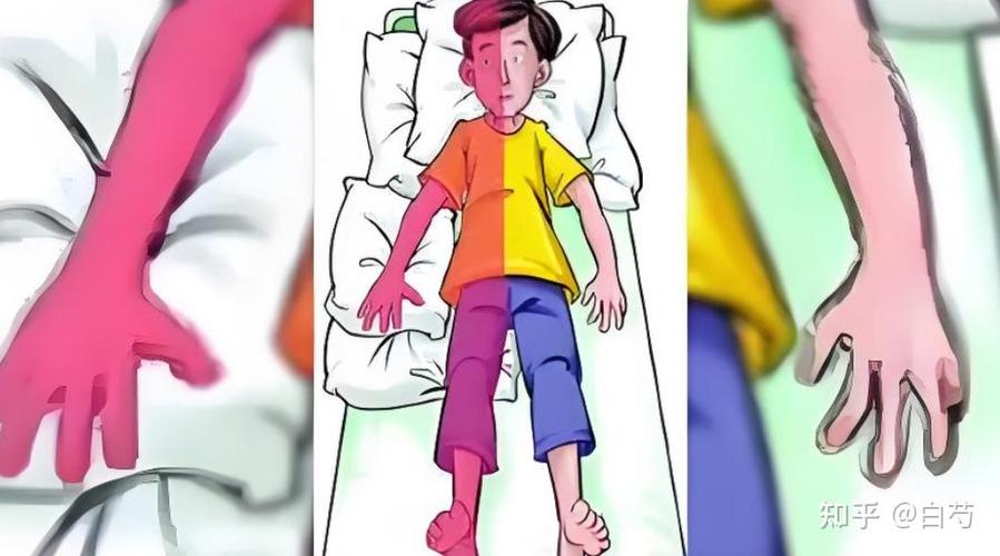 格林巴利综合征的临床表现图标
