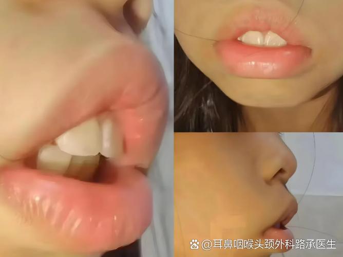 苹果怎么设置面容直接开锁图标
