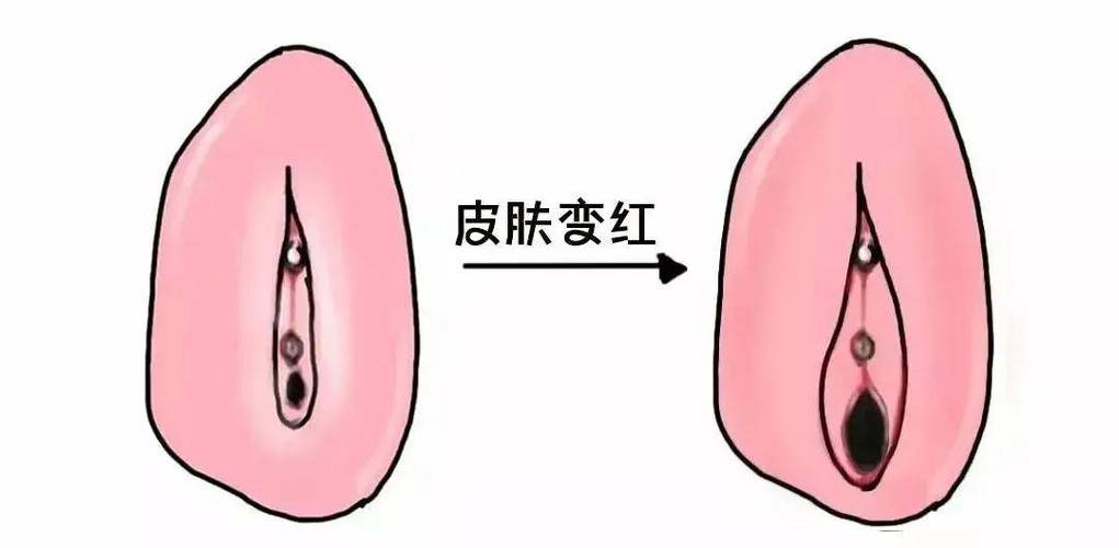 3岁女孩外阴口有洞洞正常吗图标