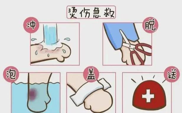 被燃烧瓶烧了怎么急救截图