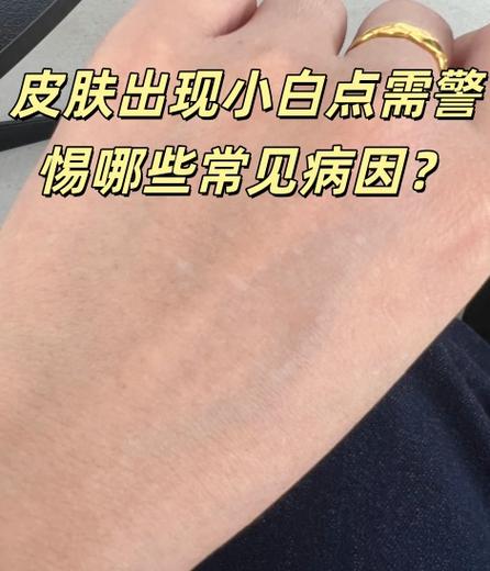 屏幕出现小白点要警惕图标