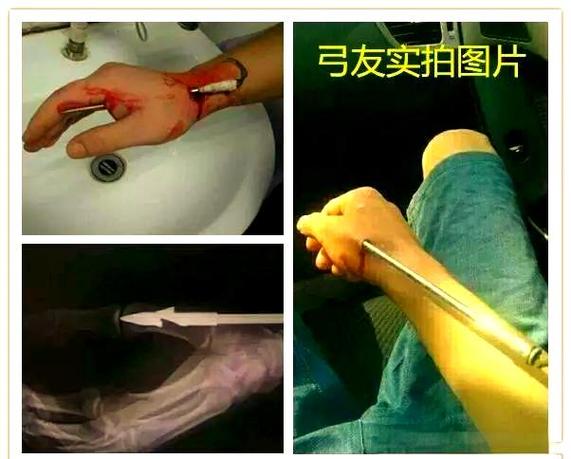 用钉子自制射鱼镖教程截图