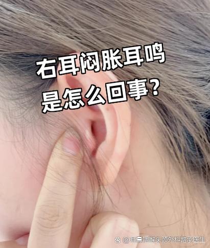 耳机声音突然变闷了图标