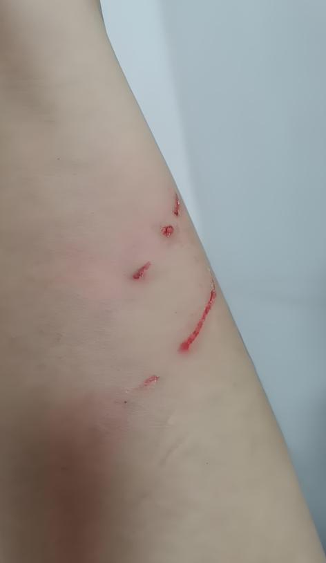 被小奶猫咬了需要打疫苗吗截图