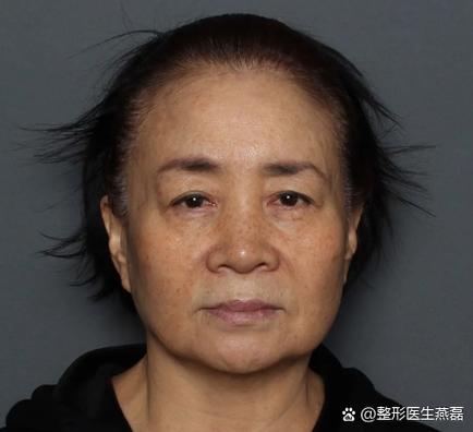 别人说你整容怎么回怼图标