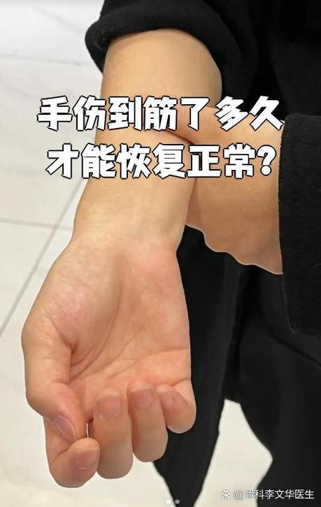 手筋自己动怎么回事截图