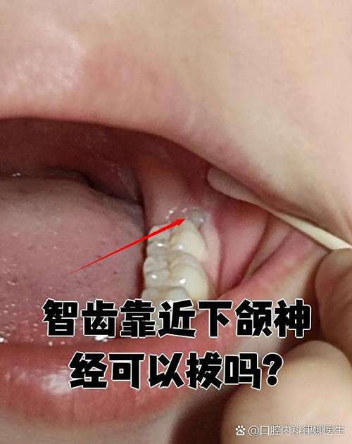 智齿在哪个位置图片图标