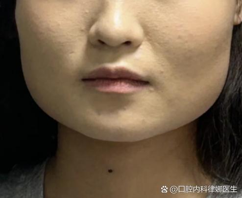 完美下颚骨