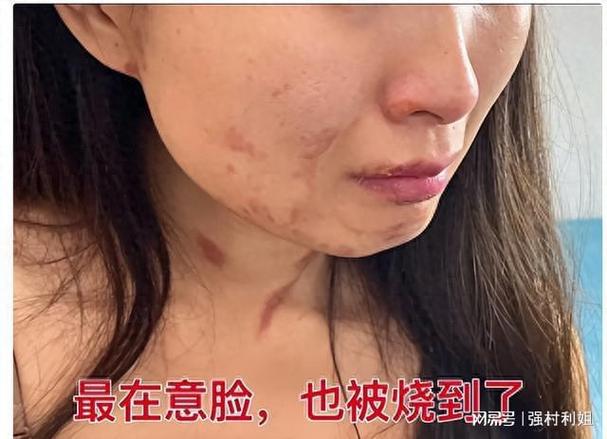 面部轻微毁容的赔偿截图