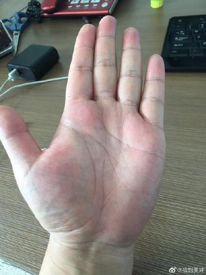 手掌是一个还是一只图标