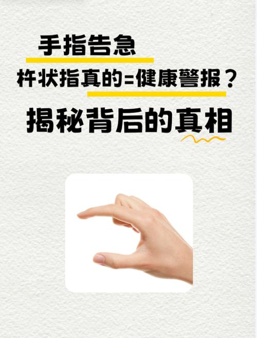 男人说手小是渣男吗图标