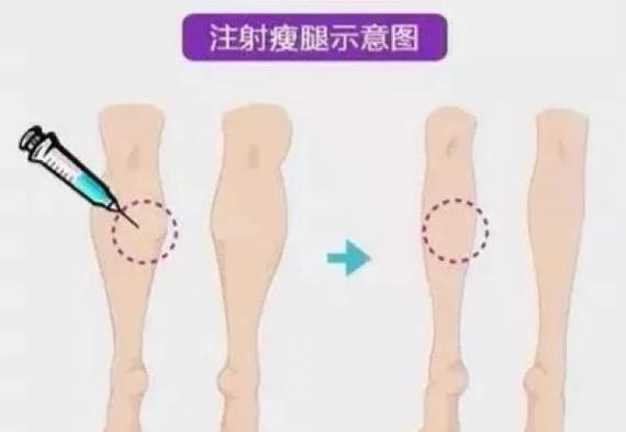 练腿怎么练图标