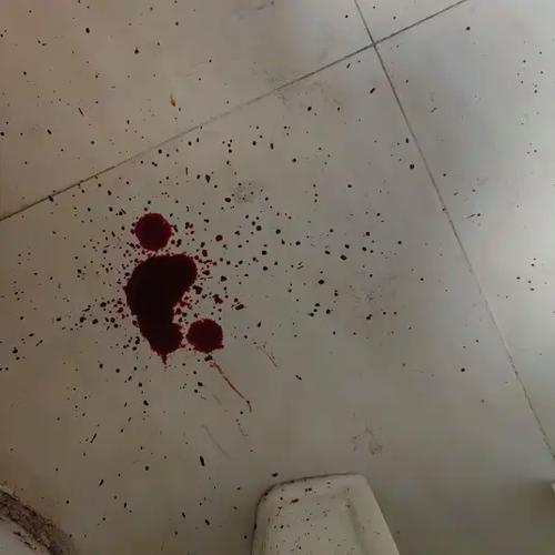 真实地上都是鼻血照片截图