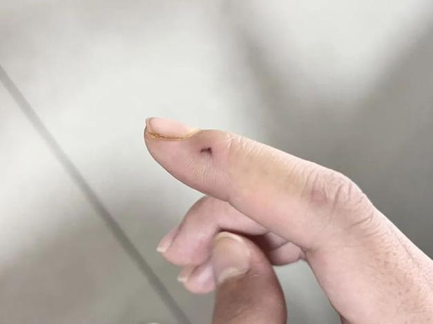 仓鼠咬我给我弄死了缩略图