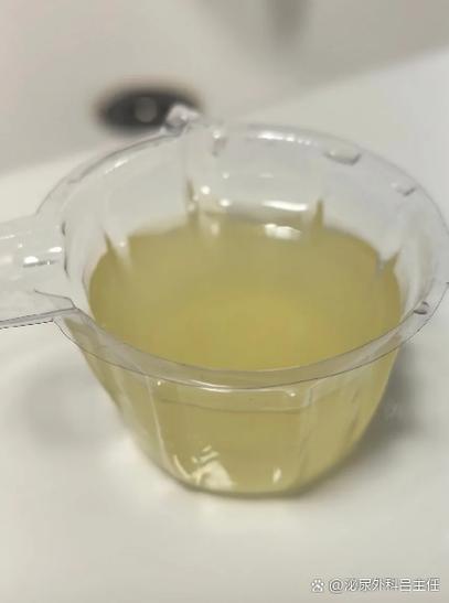 水中有棉絮状的悬浮物是什么图标