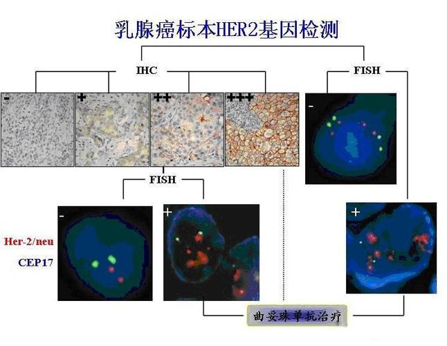 乳腺fish是查什么的截图