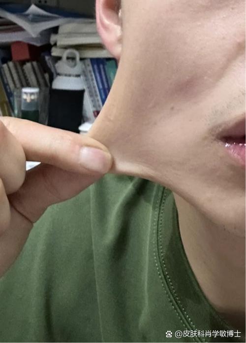 男士脸皮松弛最有效的方法图标