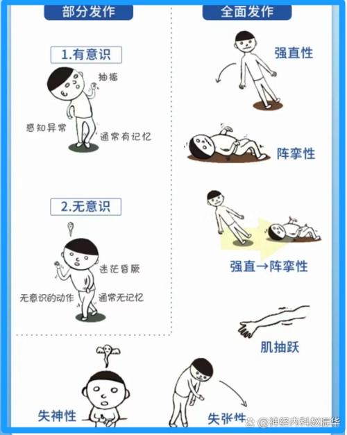 羊癫疯的症状和图片图标