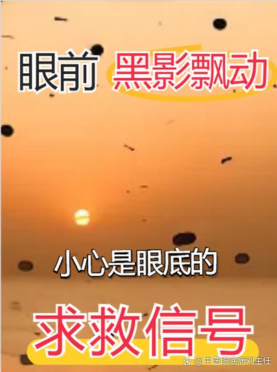 眼前有飘动的一团团黑影图标
